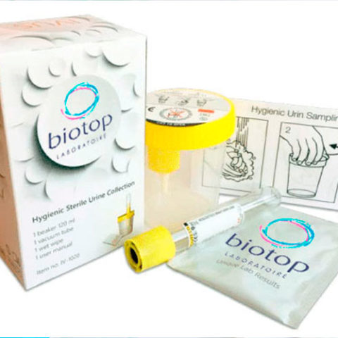 Analyse d'urines - Laboratoires Biotop